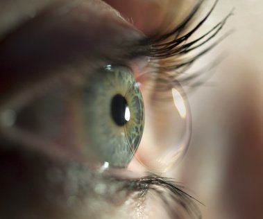 Lentilles de contact - tout savoir sur les lentilles de contact