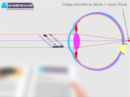 Après 45 ans, début de la presbytie & cap sur la prévention santé | Le ...