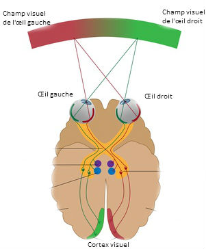 Strabisme oculaire - Comprendre le strabisme des yeux